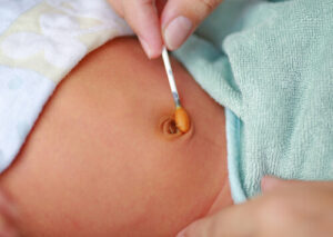 Understanding Umbilical Cord Injuries and Complications - Law Office of ...